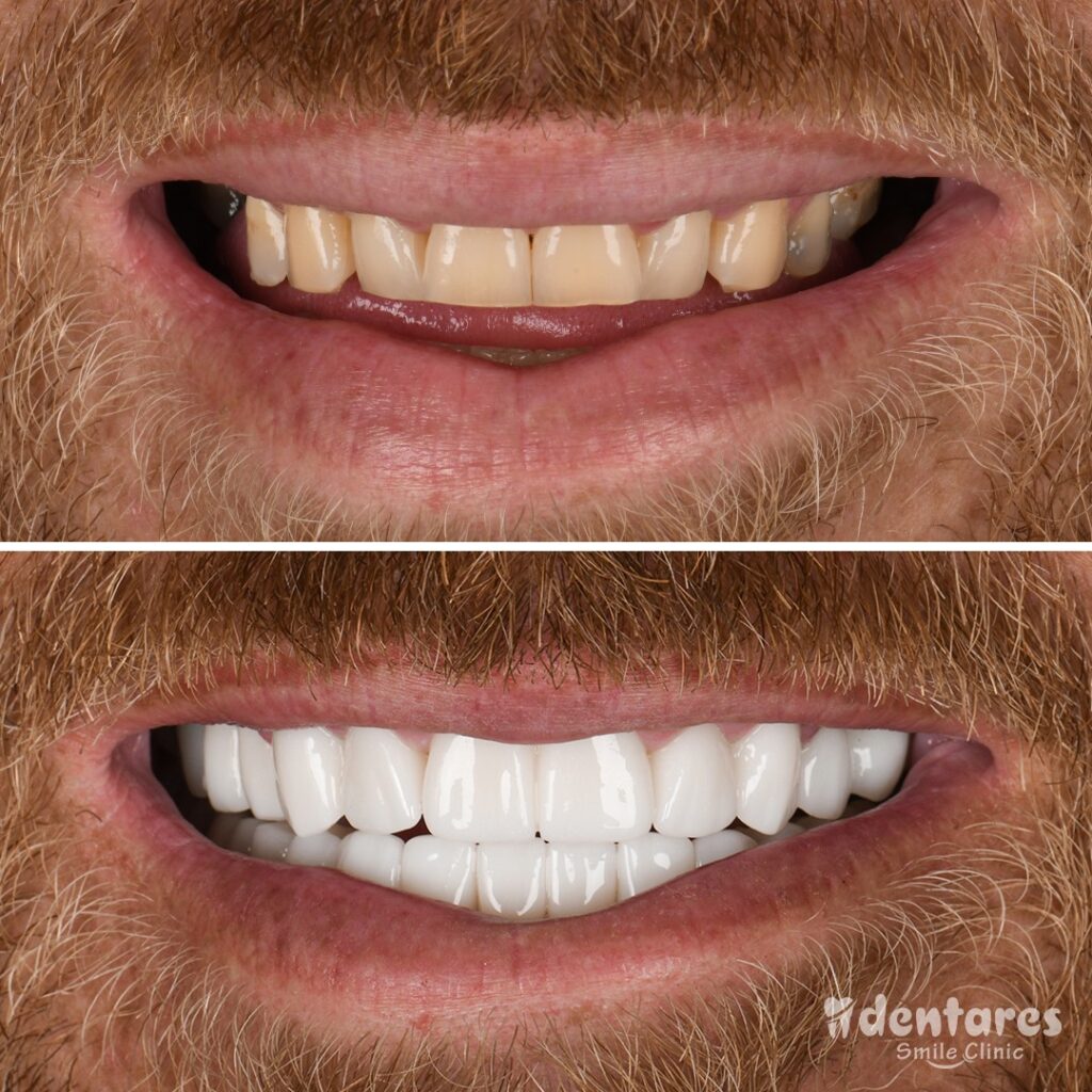 The Best Place to Get Your Teeth Done